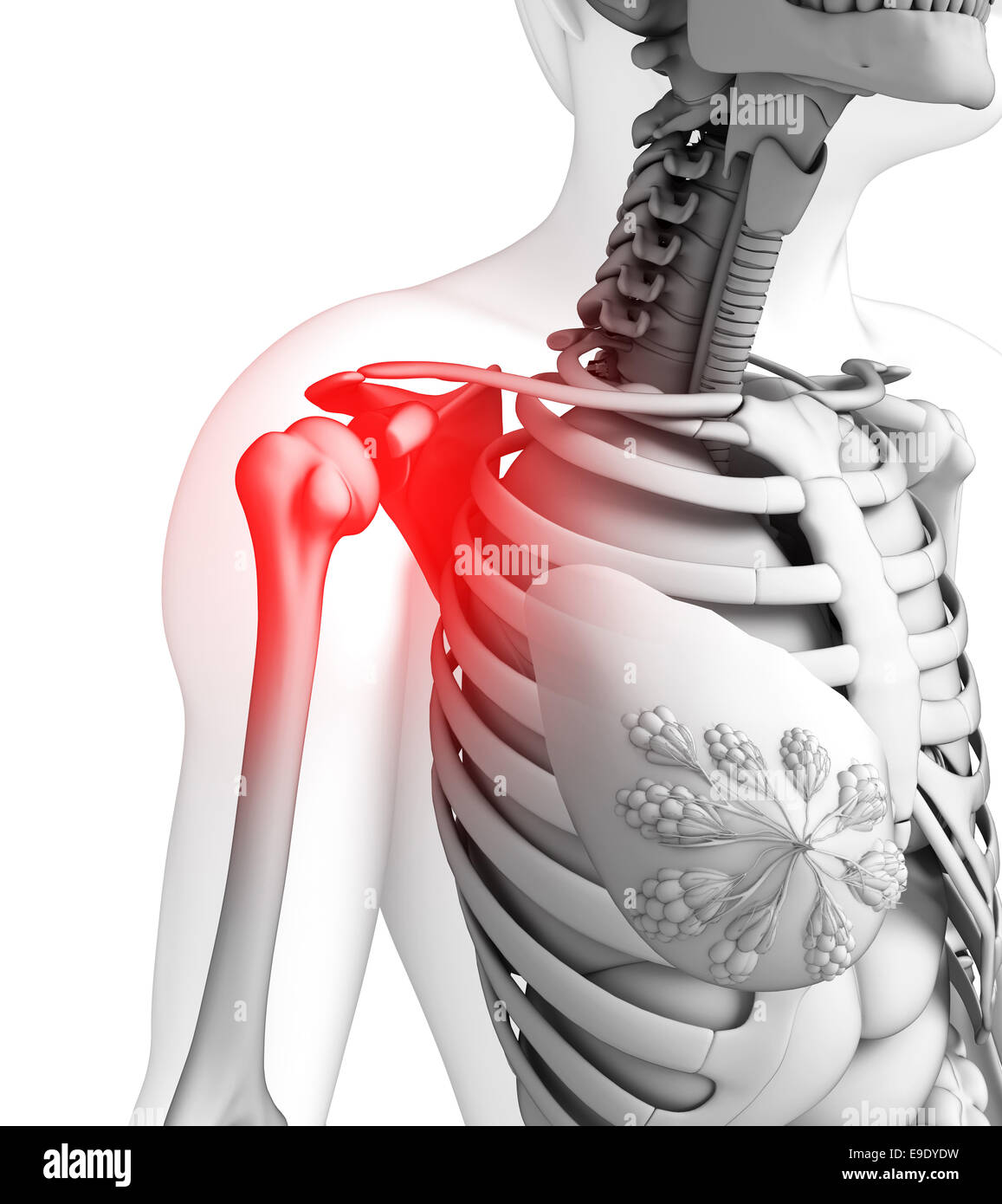 Illustration shoulder pain artwork hi-res stock photography and images ...