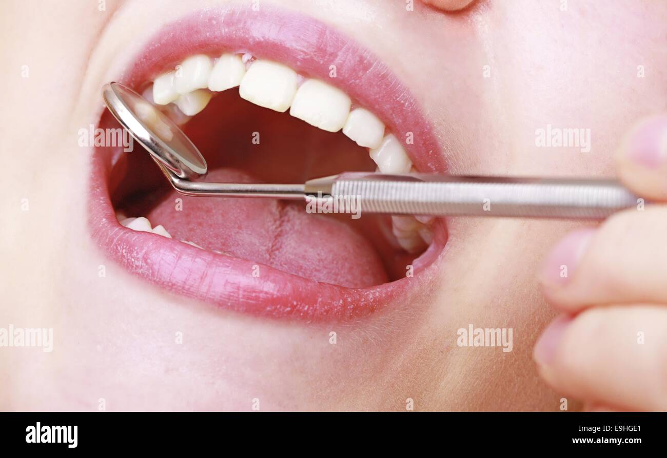 Dental care. Close-up young female having her teeth examinated. Healthy ...