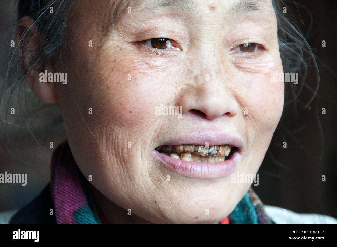 Old Long Horn Miao (Changjiao Miao) woman with bad teeth, Suoga Village ...