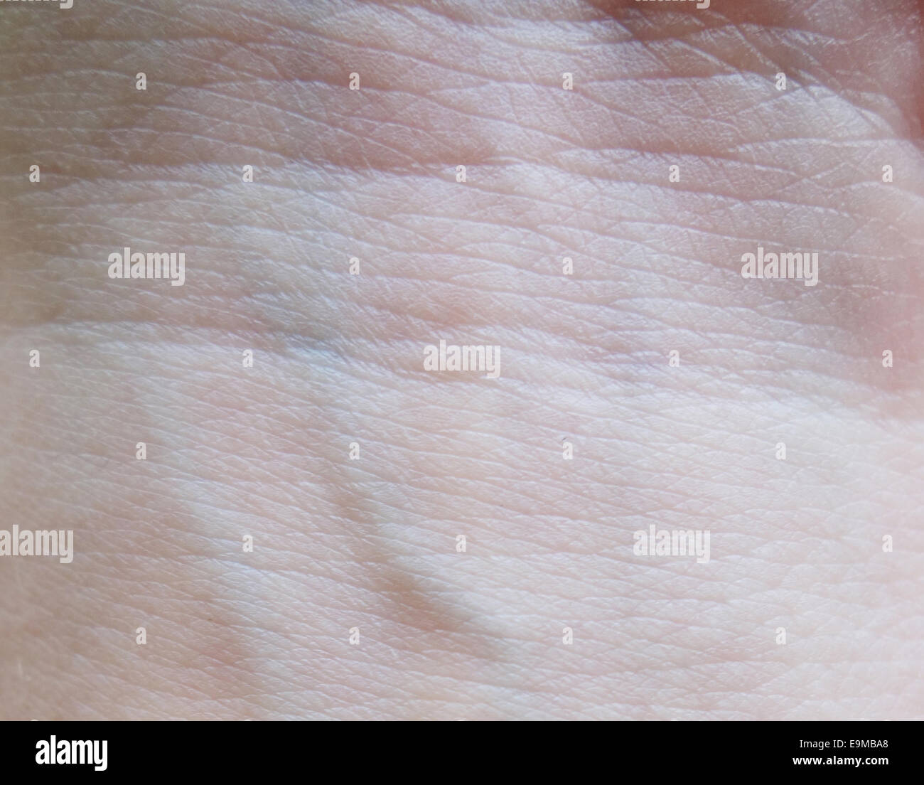 Human veins hi-res stock photography and images - Alamy