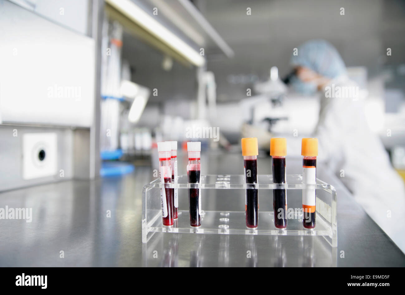 Front view of test tubes containing blood samples Stock Photo - Alamy