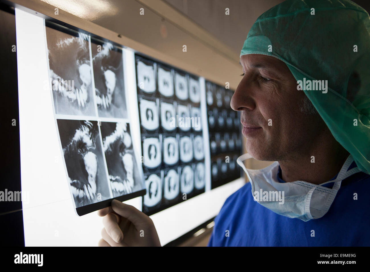 Doctor x ray lightbox hi-res stock photography and images - Alamy