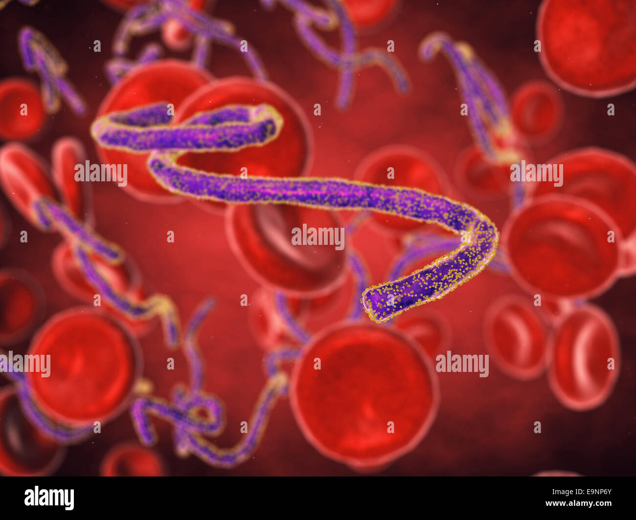 Ebola Hemorrhagic Fever Bleeding