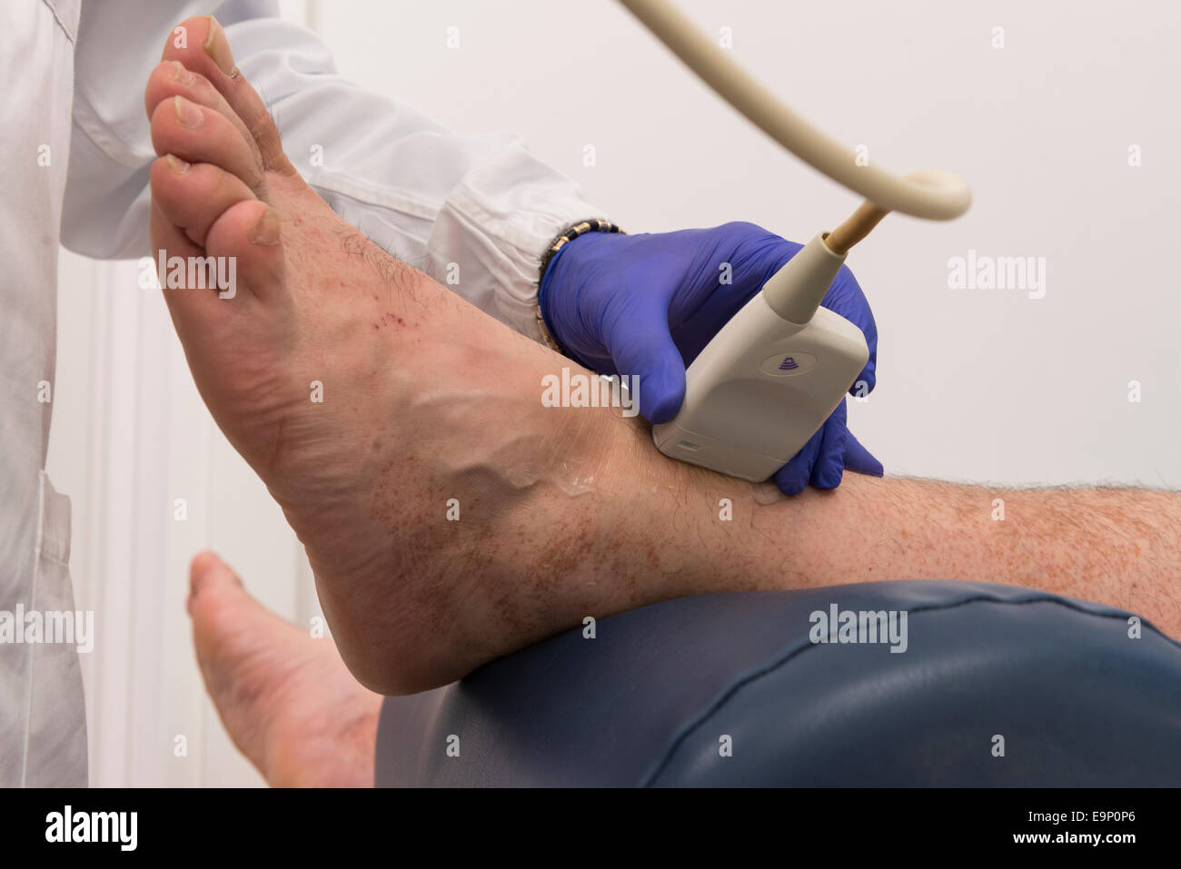 Foot echography by a medical doctor Stock Photo - Alamy