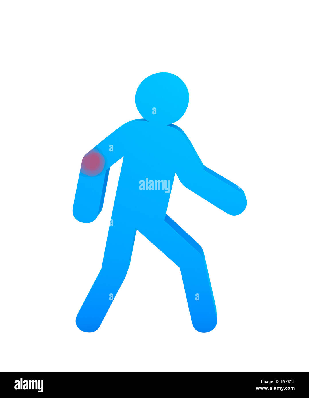 Broken arm hi-res stock photography and images - Alamy