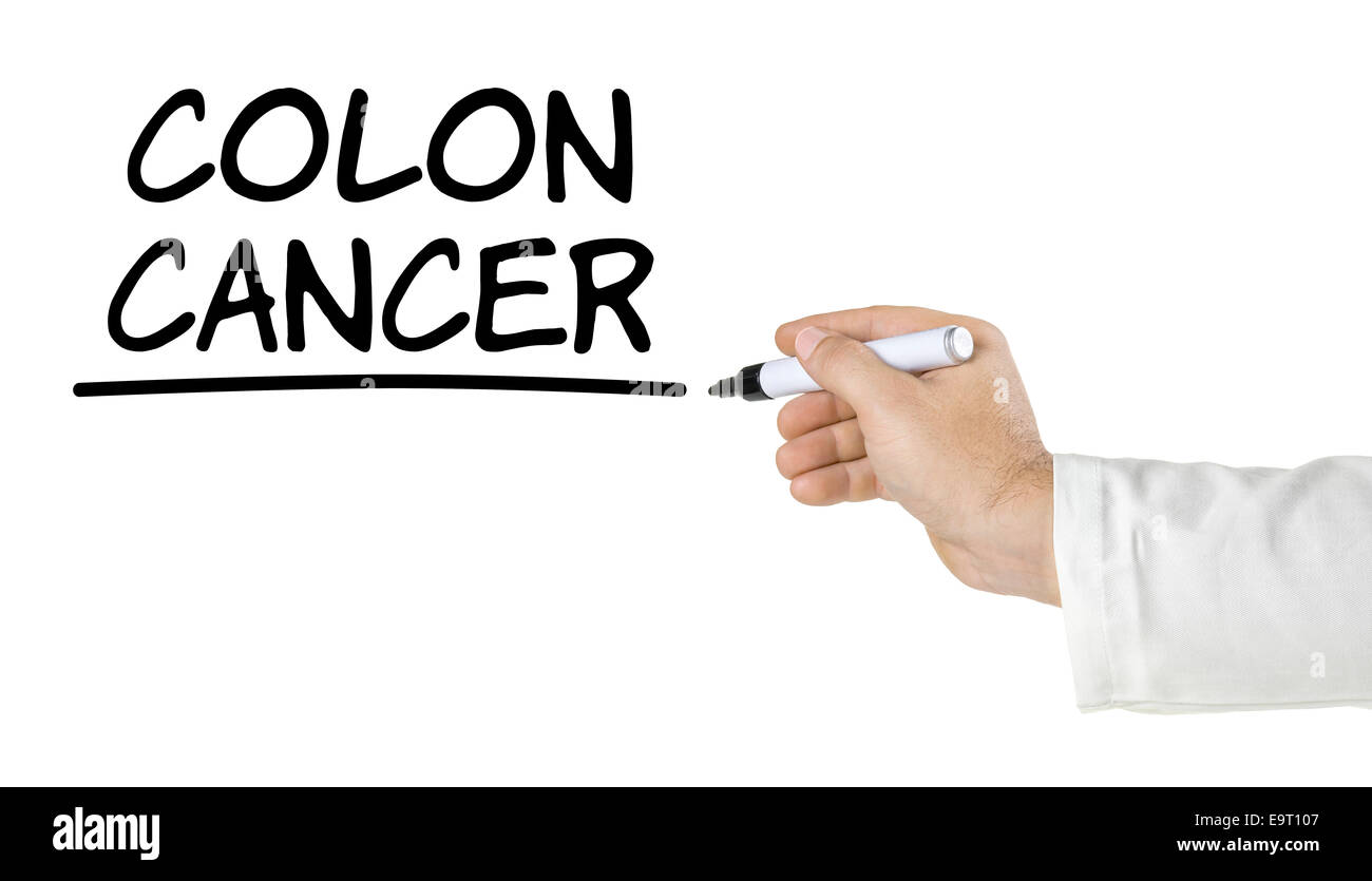 Colorectal cancer illustration Cut Out Stock Images & Pictures - Alamy