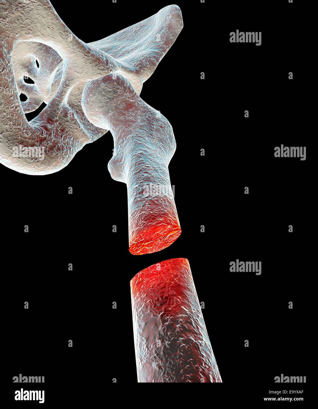 Broken skeleton hi-res stock photography and images - Alamy