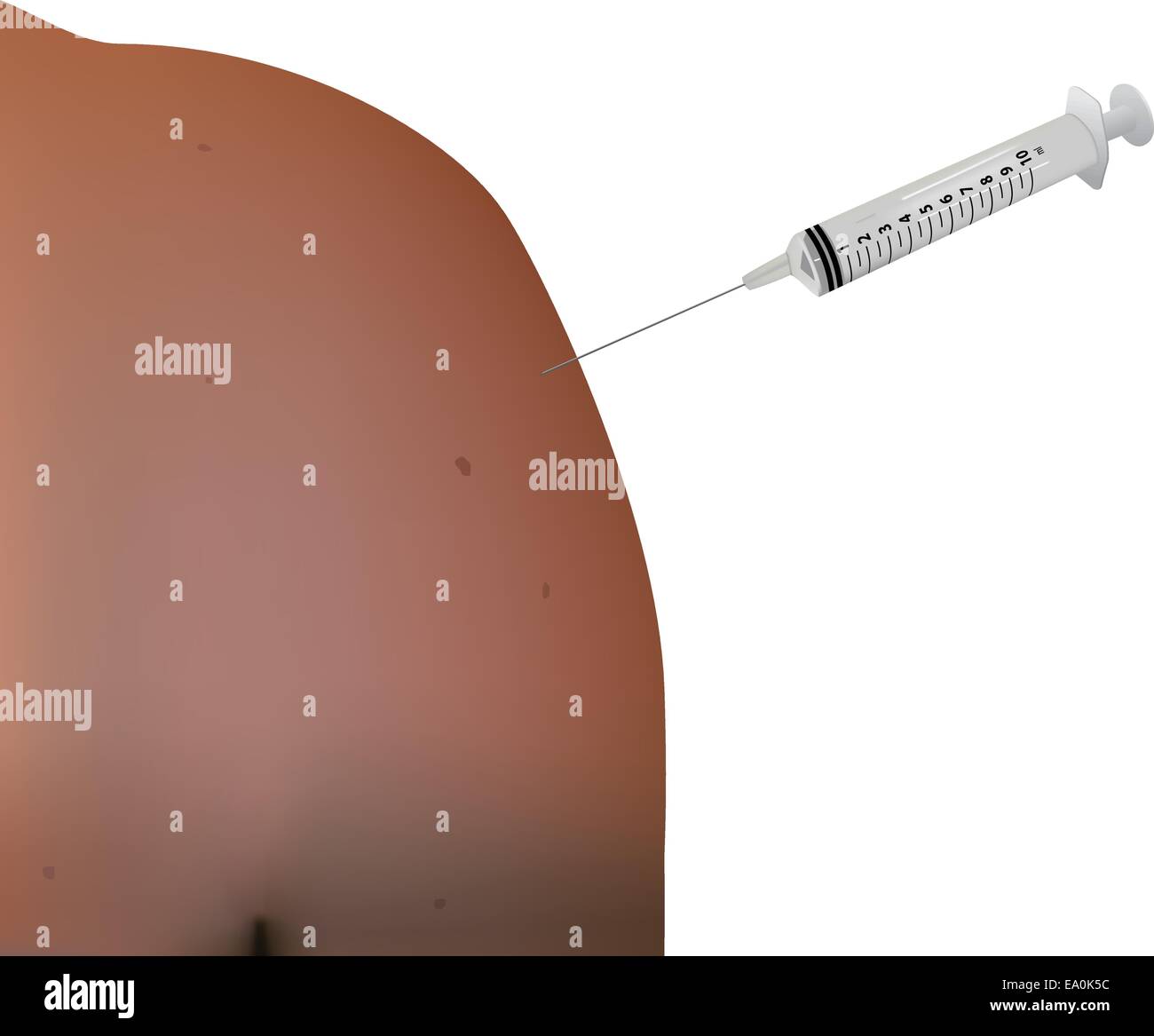 Close up syringe treatment Stock Vector Images - Alamy