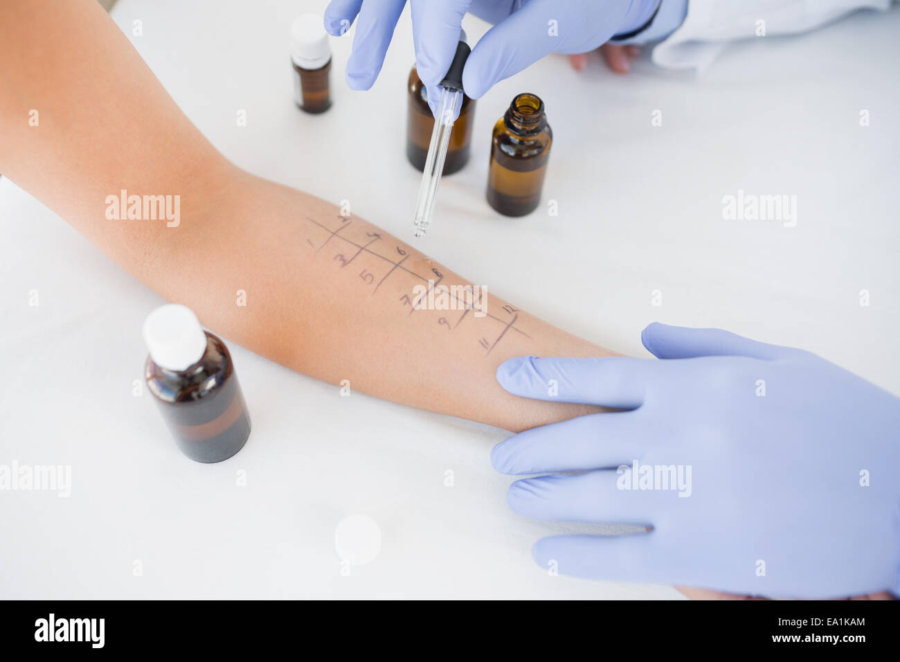 Doctor dropping medicine on hand of patient Stock Photo - Alamy