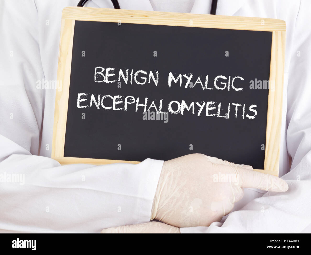 Doctor shows information: benign myalgic encephalomyelitis Stock Photo ...