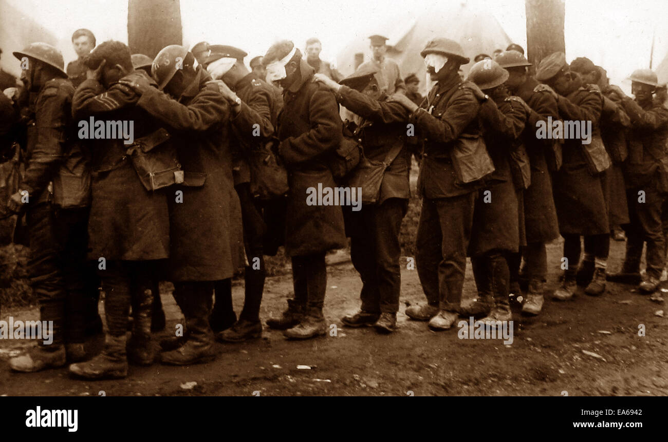 British troops blinded by gas at Bethune France 10th April 1918 WW1 ...
