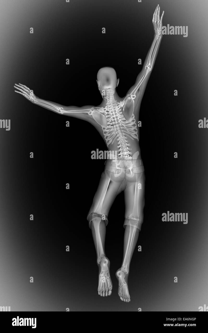 Human bones radiography scan hi-res stock photography and images - Alamy