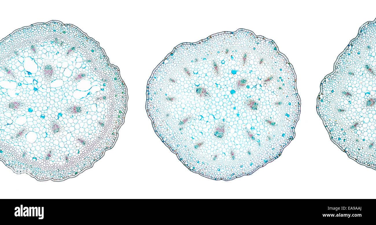 Microscope osmosis vascular bundles xylem pith wild tulip stem ts hi ...