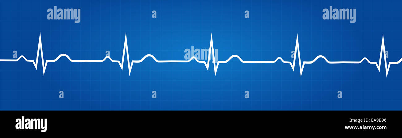 Blueprint Of Normal Electrocardiogram Graphic Stock Photo - Alamy