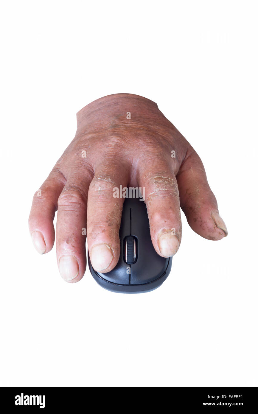 male hands with dermatoses using mouse in white background Stock Photo ...