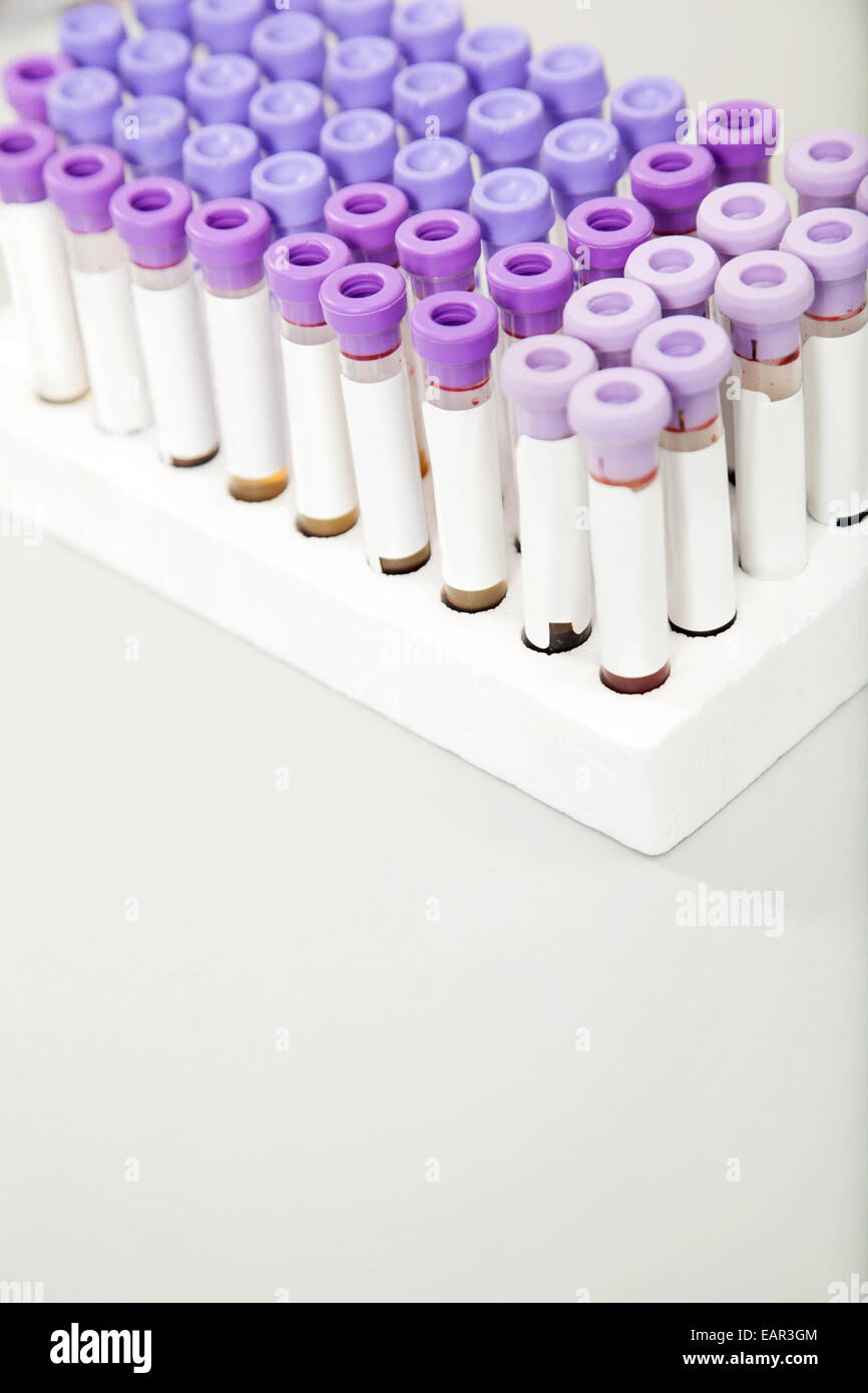 Rows Of Test Tubes Stock Photo - Alamy