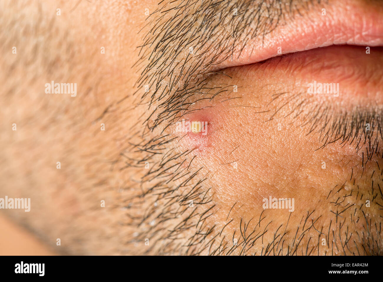 Upper lip hi-res stock photography and images - Alamy