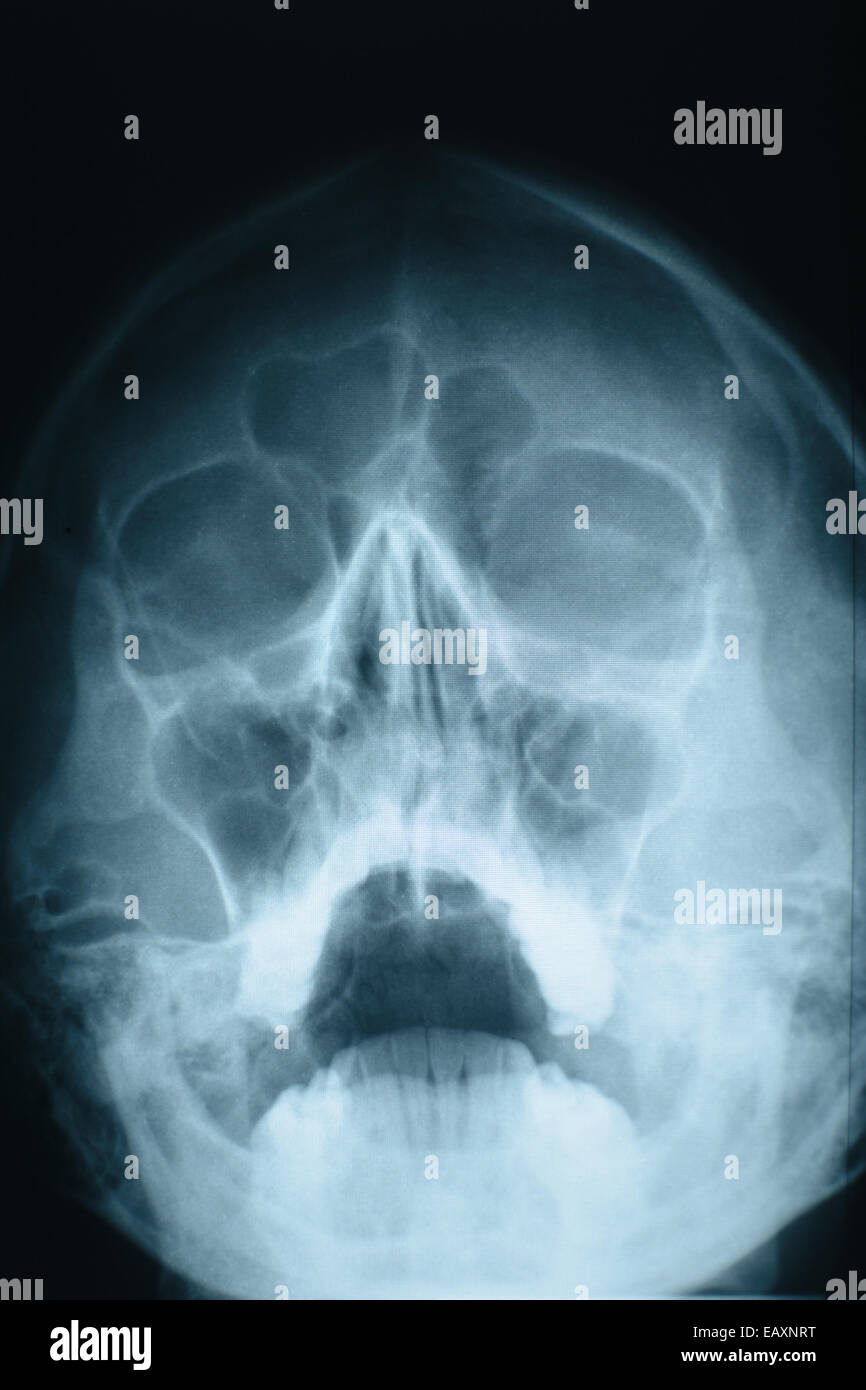 Gamma ray scan hi-res stock photography and images - Alamy