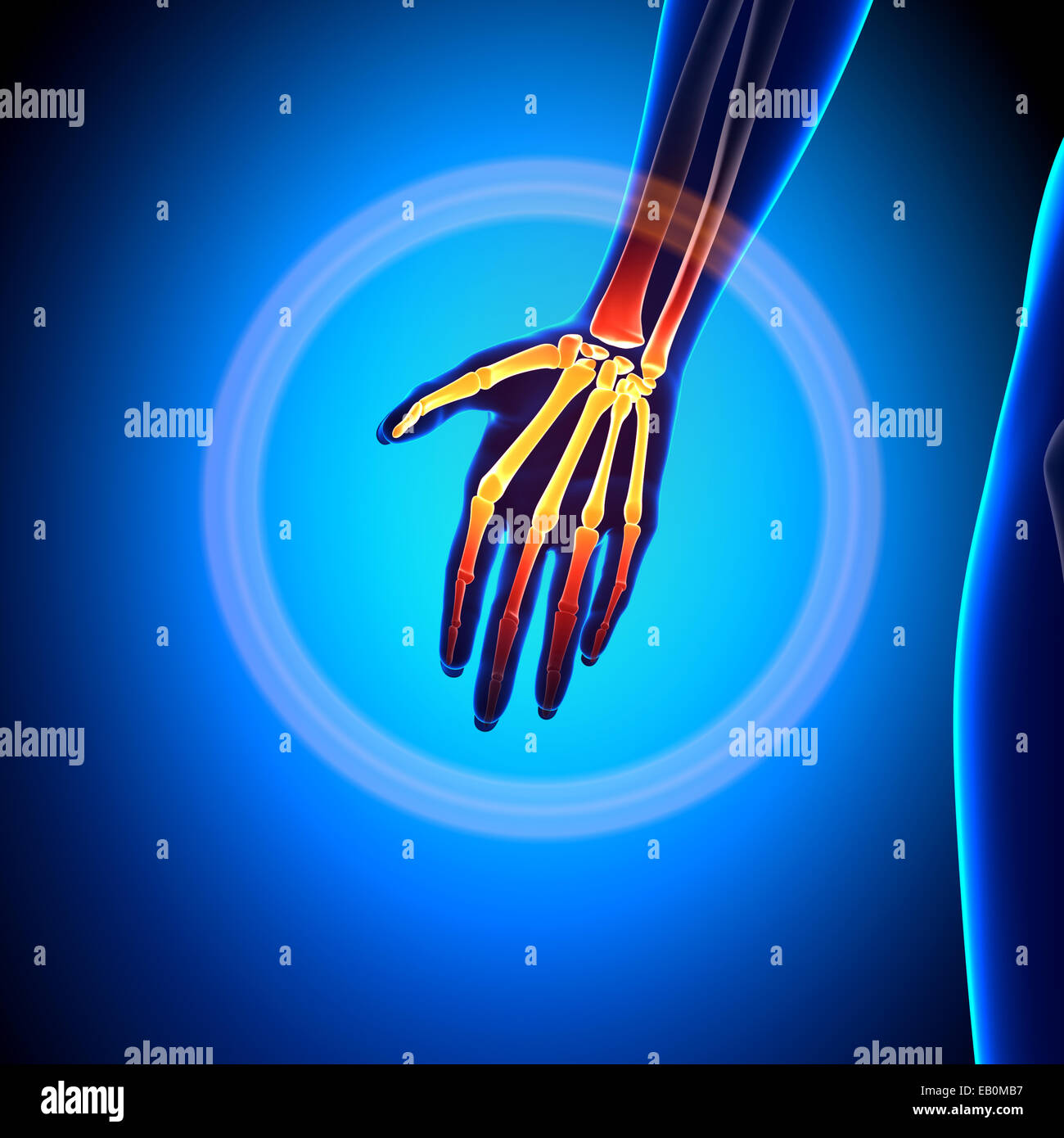 Blue xray of arm hi-res stock photography and images - Alamy