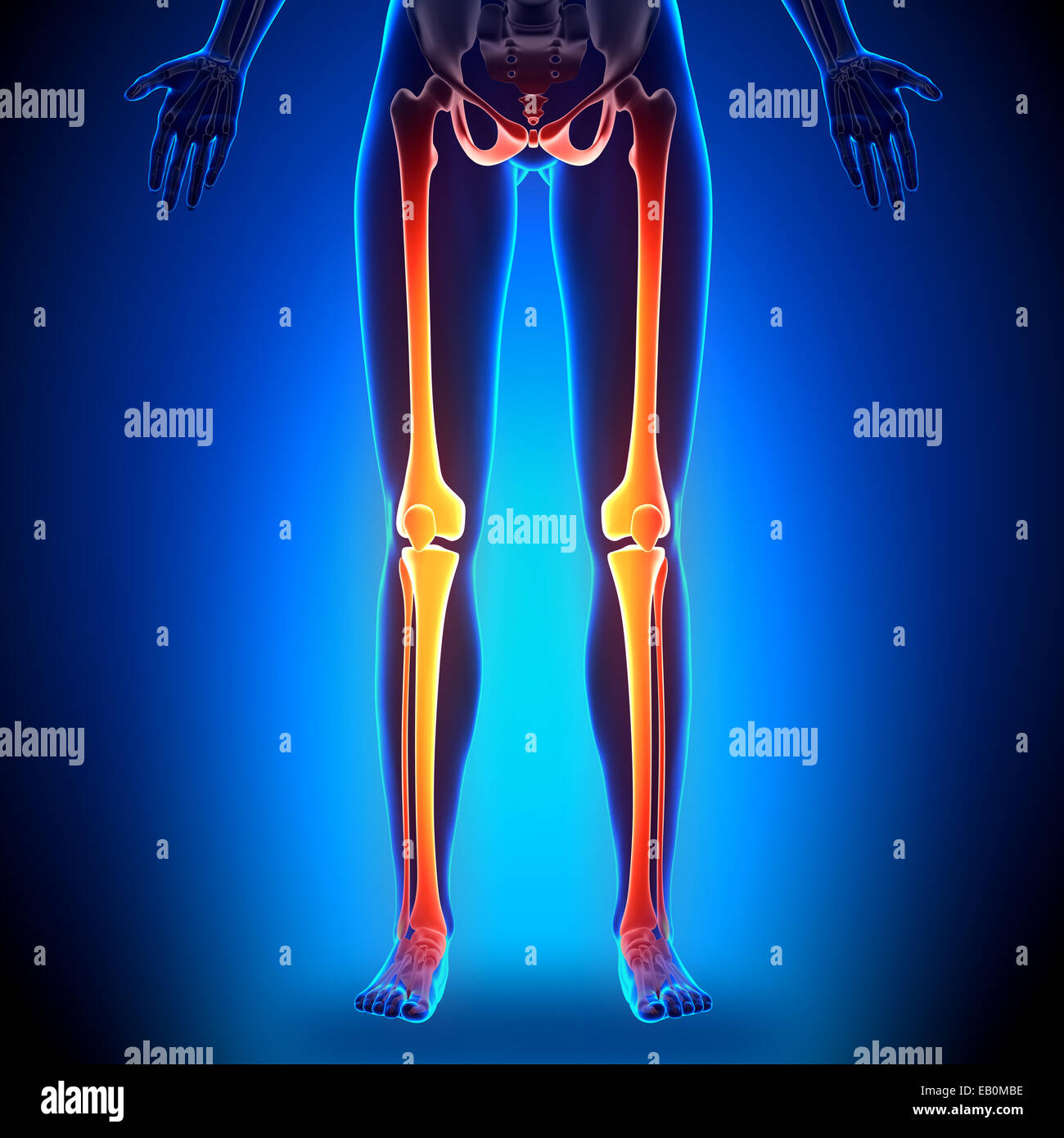 Broken hip bone xray hi-res stock photography and images - Alamy