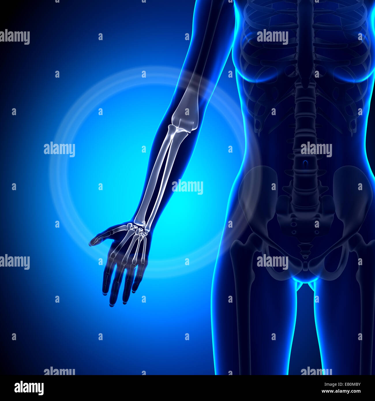 Forearm Muscle Strain High Resolution Stock Photography and Images - Alamy