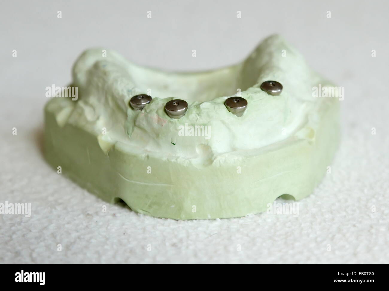 Cast model with four implant preparations on upper jaw Stock Photo - Alamy