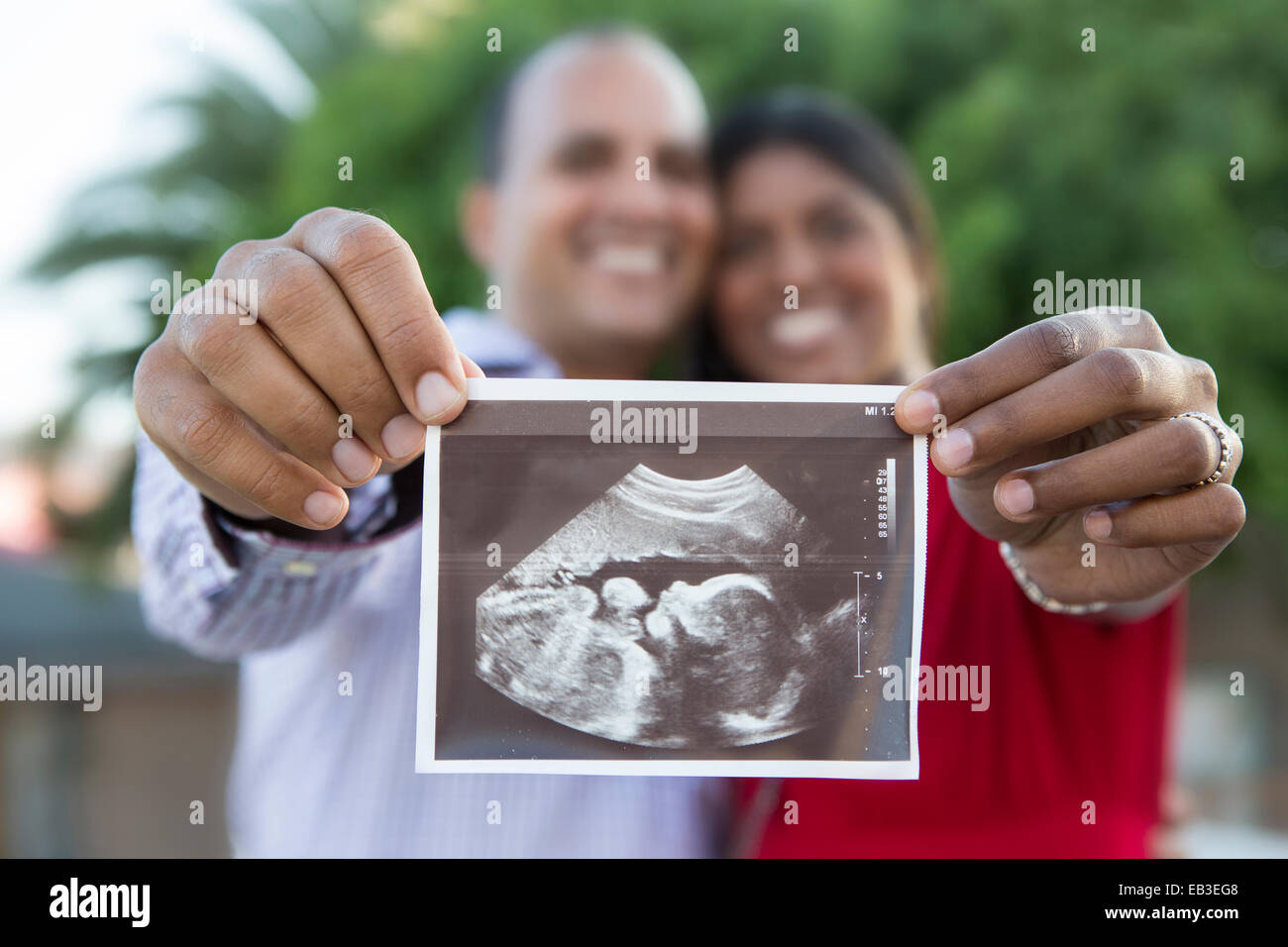 Happy couple holding sonogram Stock Photo - Alamy