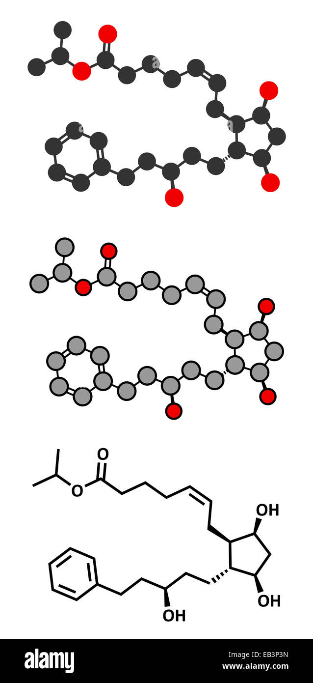 Glaucoma drawing hi-res stock photography and images - Alamy