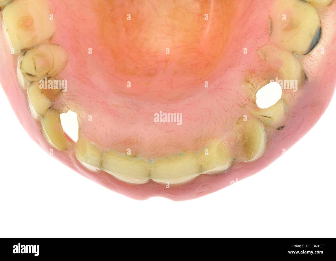 Old worn dentures with holes and cracks Stock Photo - Alamy