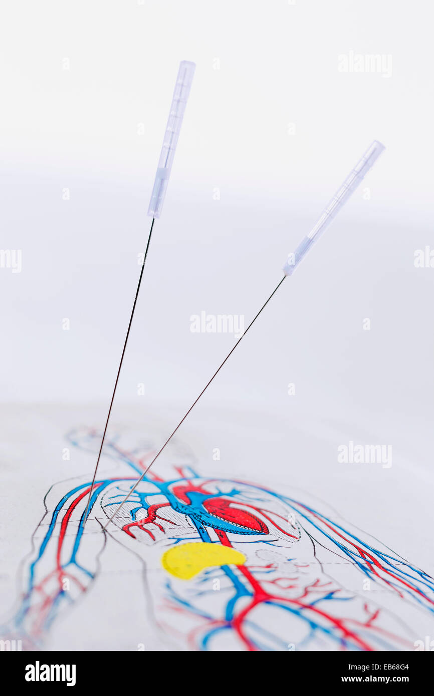 Acupuncture drawing hi-res stock photography and images - Alamy