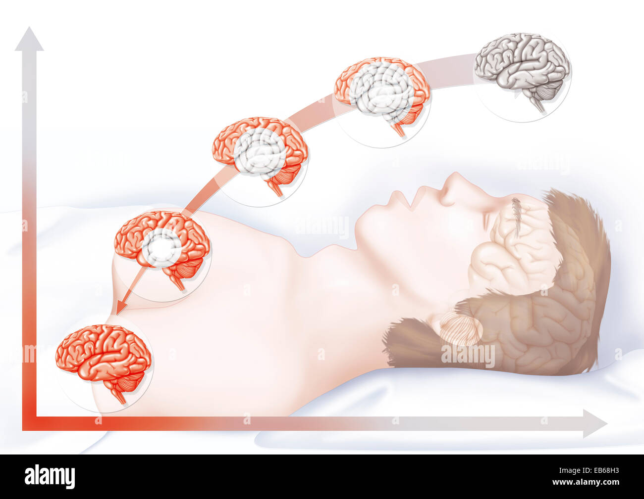 Bed ridden medical illustration hi-res stock photography and images - Alamy