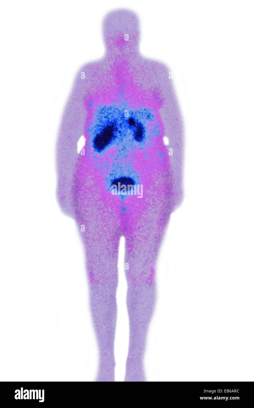 Scintiscanners hi-res stock photography and images - Alamy