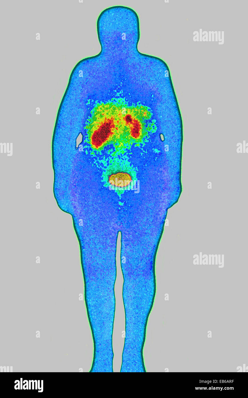 Scintiscanner hi-res stock photography and images - Alamy