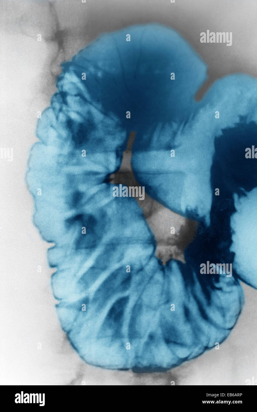 Healthy colon hi-res stock photography and images - Alamy