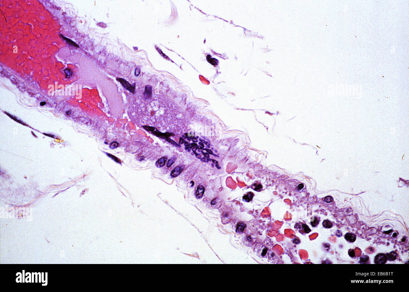 NIPAH VIRUS INFECTION Stock Photo - Alamy