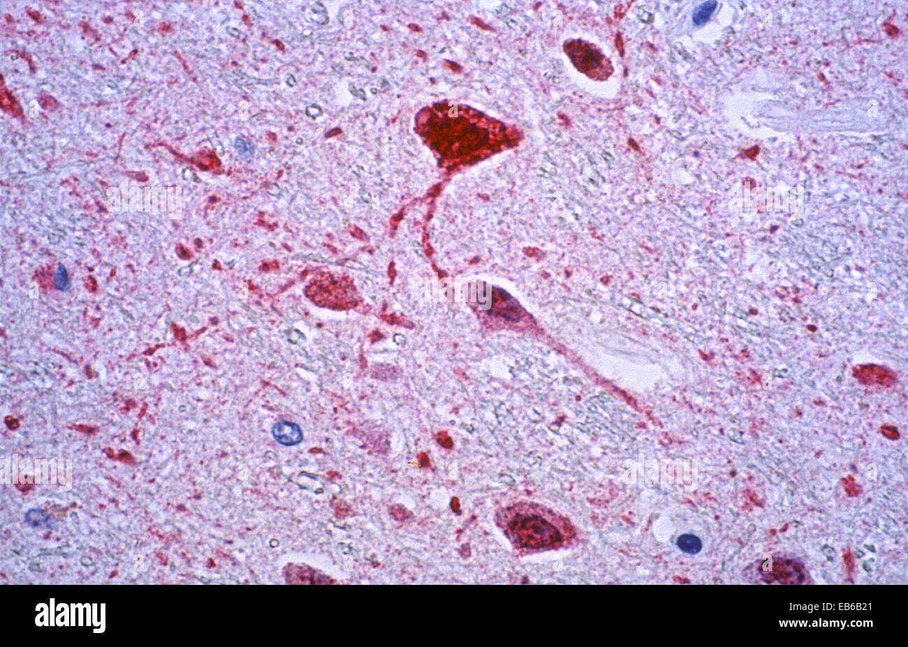 NIPAH VIRUS INFECTION Stock Photo - Alamy NIPAH VIRUS INFECTION Stock Photo - Alamy