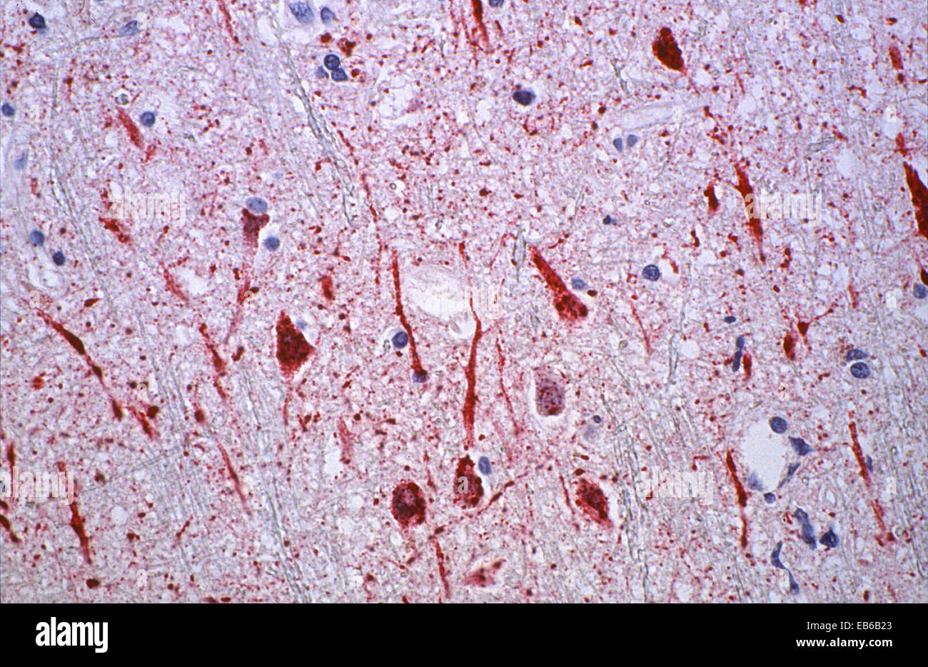 NIPAH VIRUS INFECTION Stock Photo - Alamy