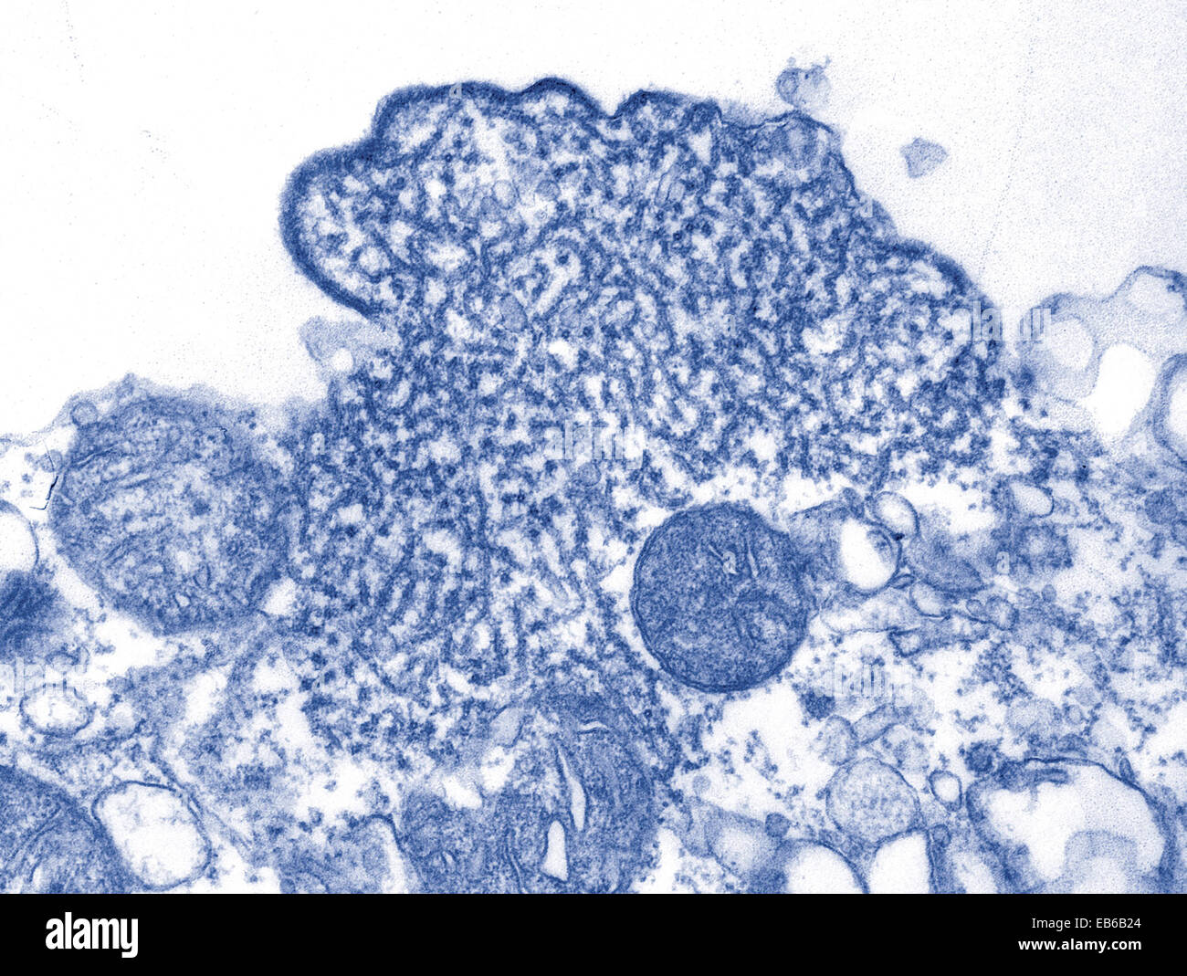 Spinal infections hi-res stock photography and images - Alamy