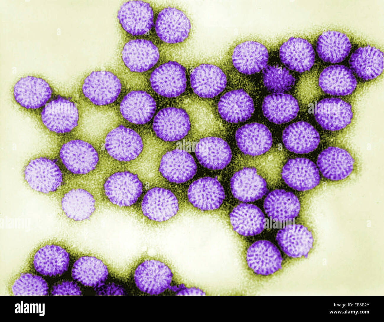 Rotavirus electron hi-res stock photography and images - Alamy