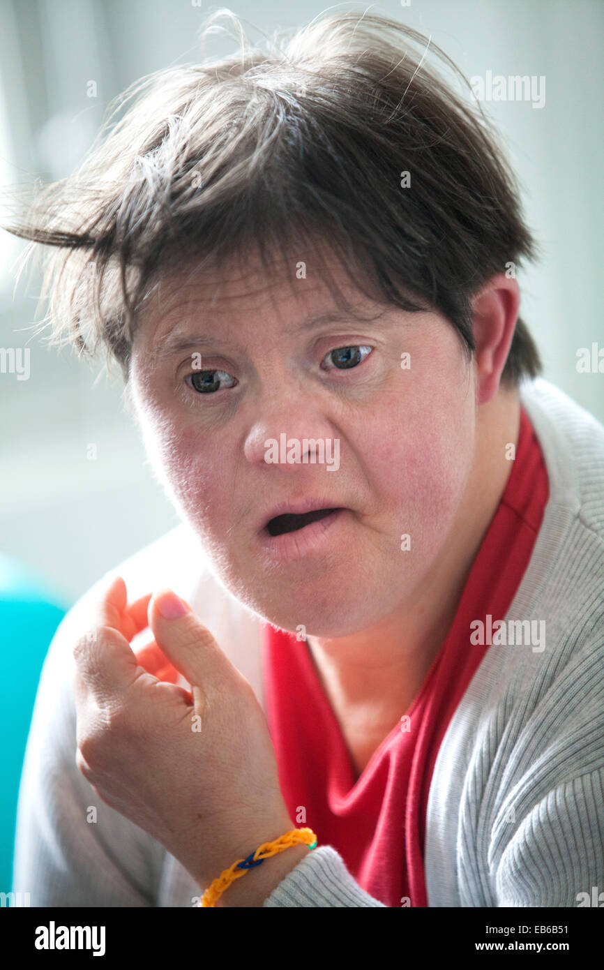 ADULT, DOWN'S SYNDROME Stock Photo - Alamy