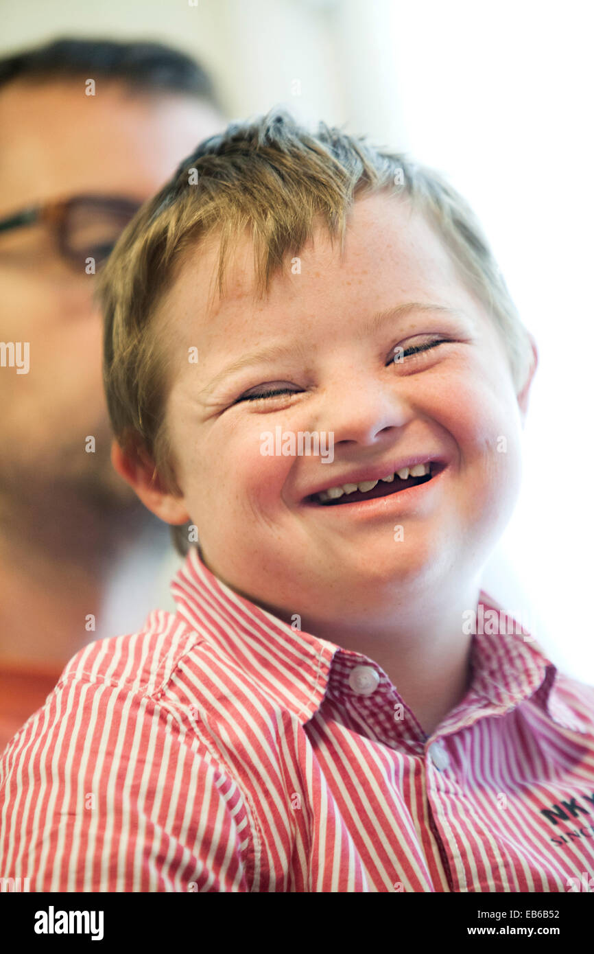 CHILD, DOWN'S SYNDROME Stock Photo - Alamy
