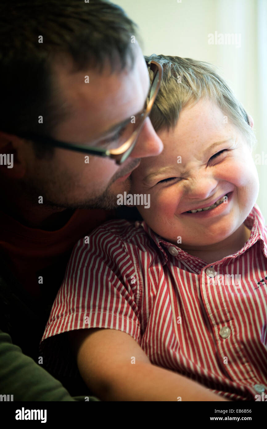 CHILD, DOWN'S SYNDROME Stock Photo - Alamy