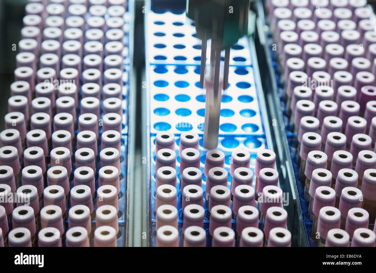 Hemogram hi-res stock photography and images - Alamy
