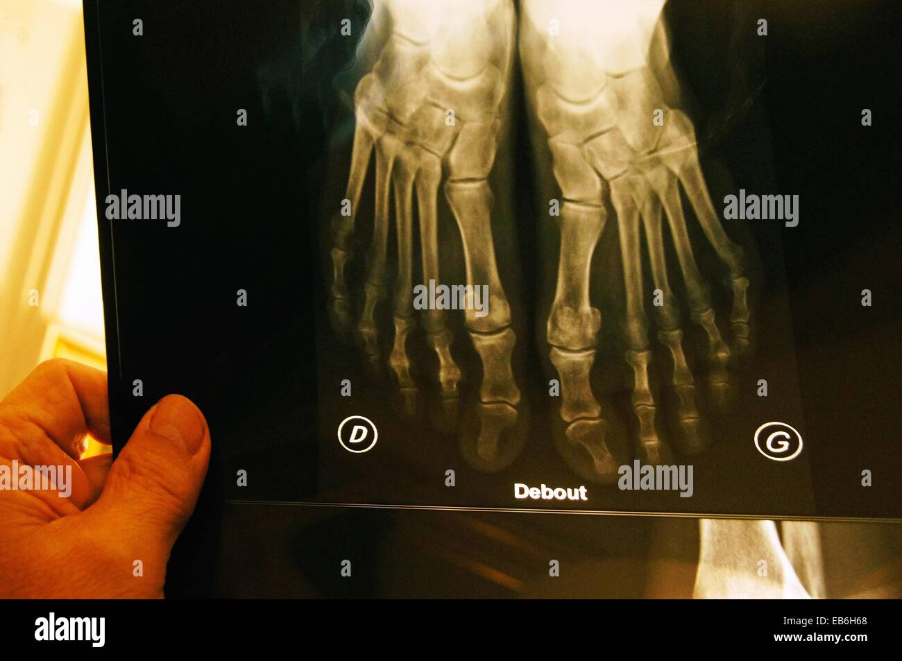 Radiography testing hi-res stock photography and images - Alamy