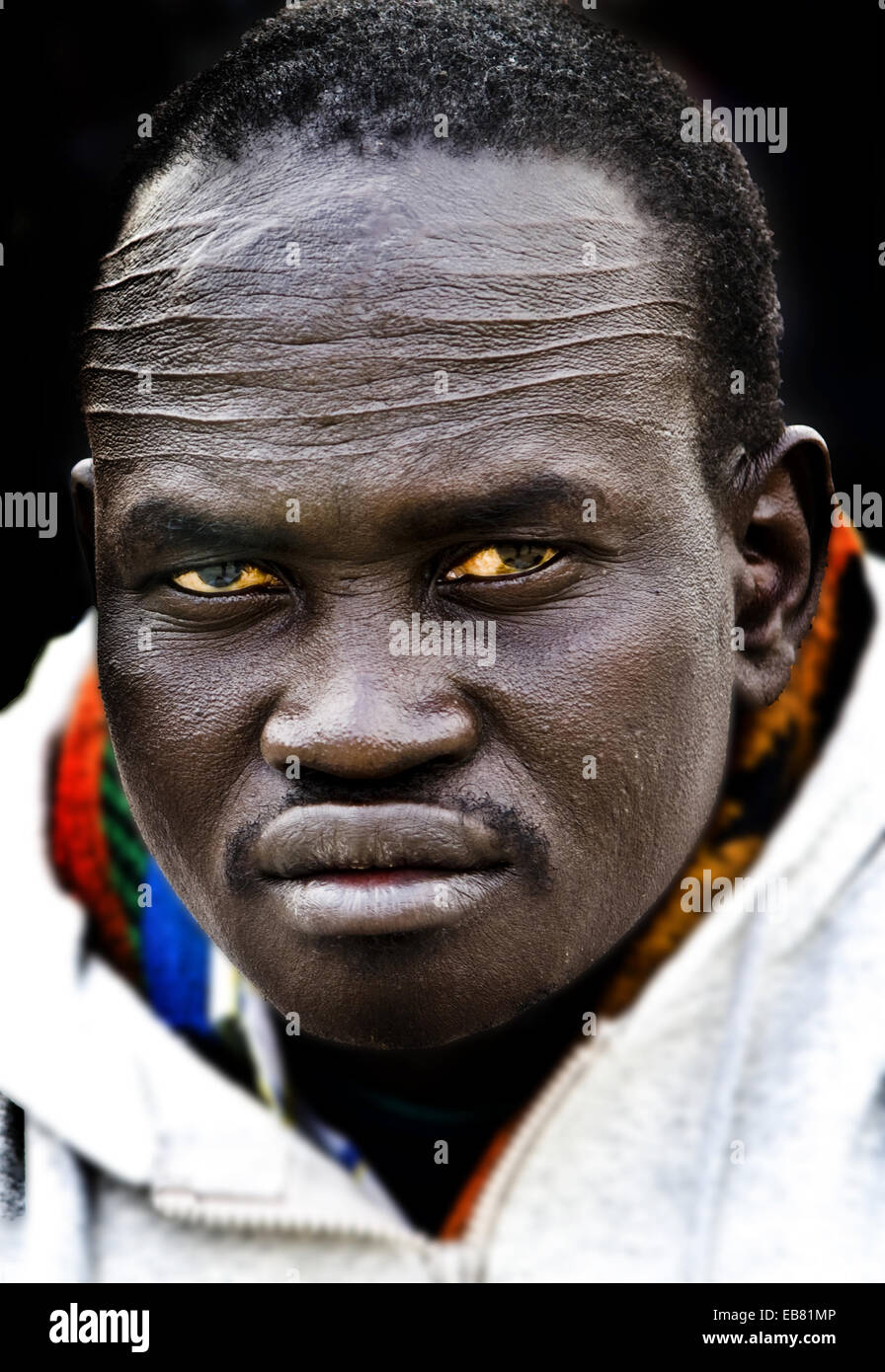 Nuer Tribe Scars