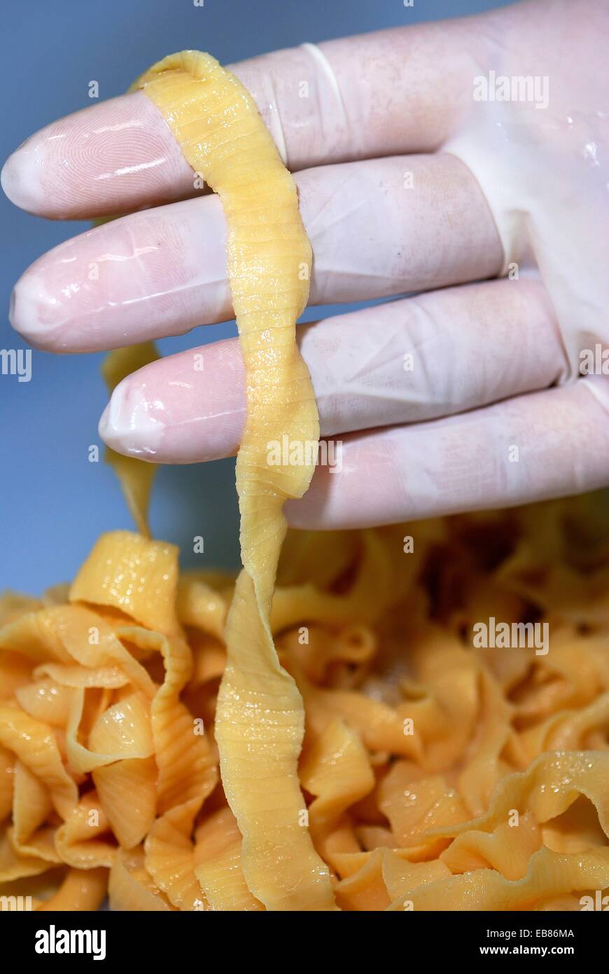 Beef Tapeworm Proglottid Segments Taenia Saginata