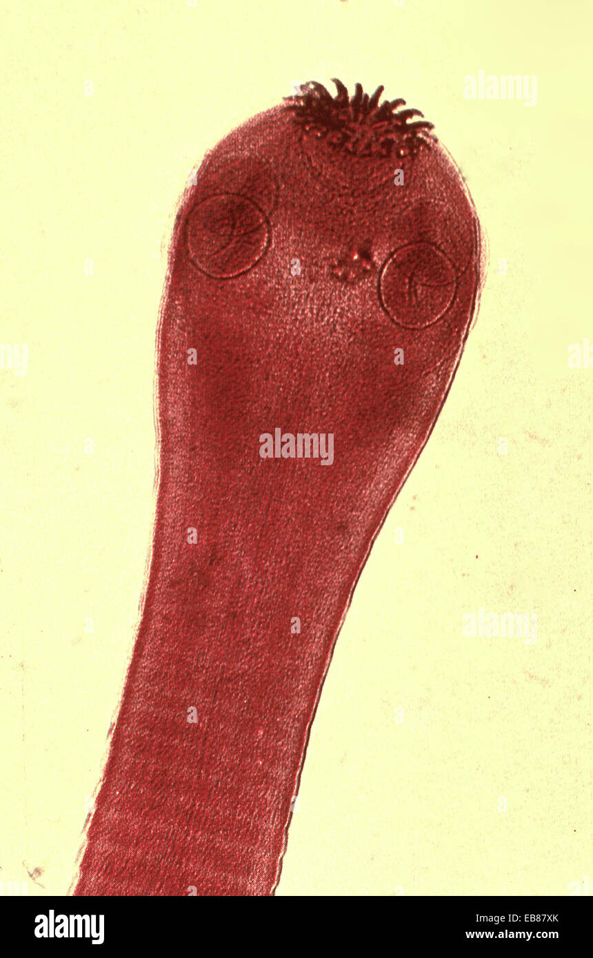 Tapeworms High Resolution Stock Photography and Images - Alamy