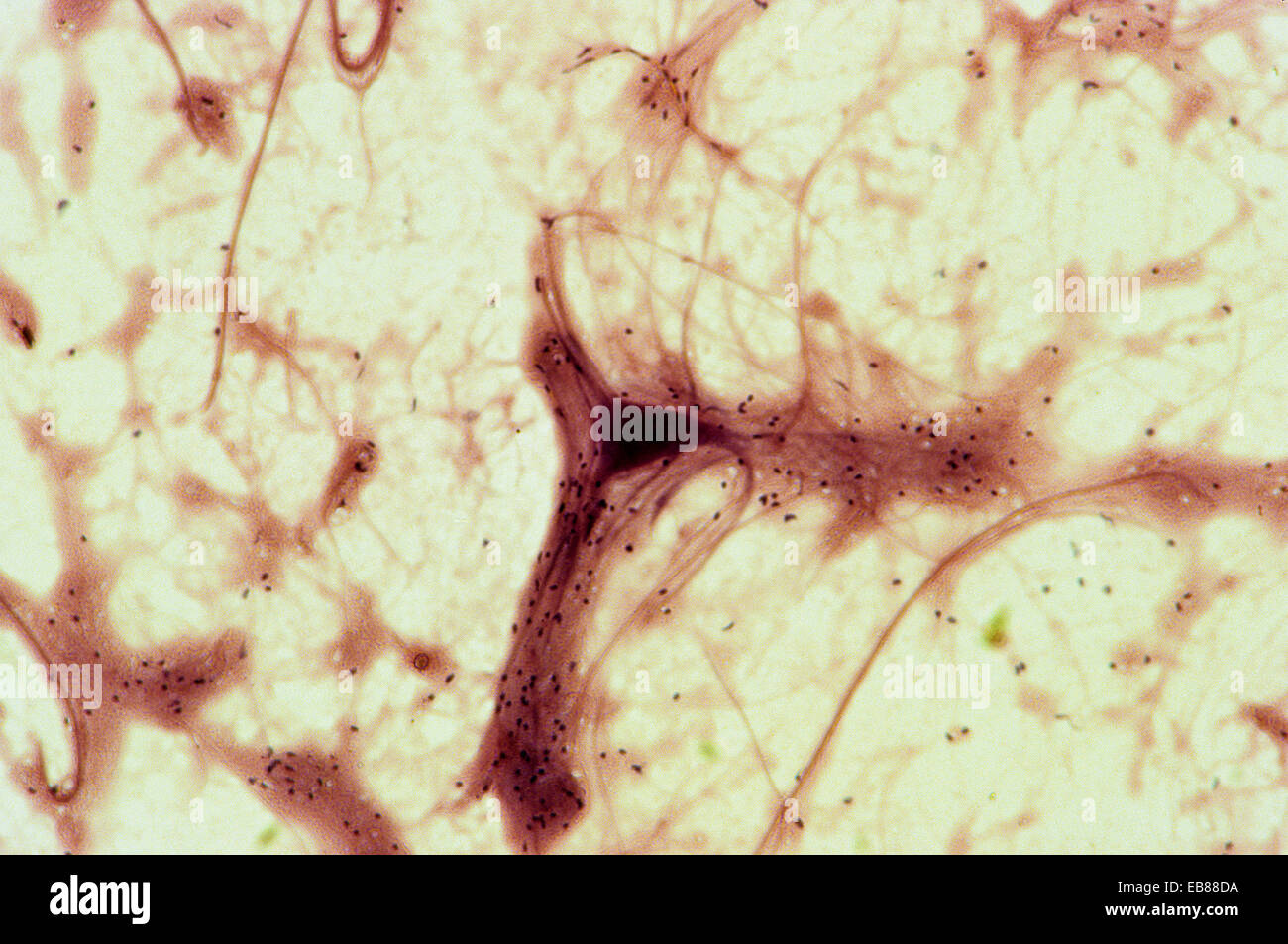 Neuron Microscope Stock Photos & Neuron Microscope Stock Images - Alamy