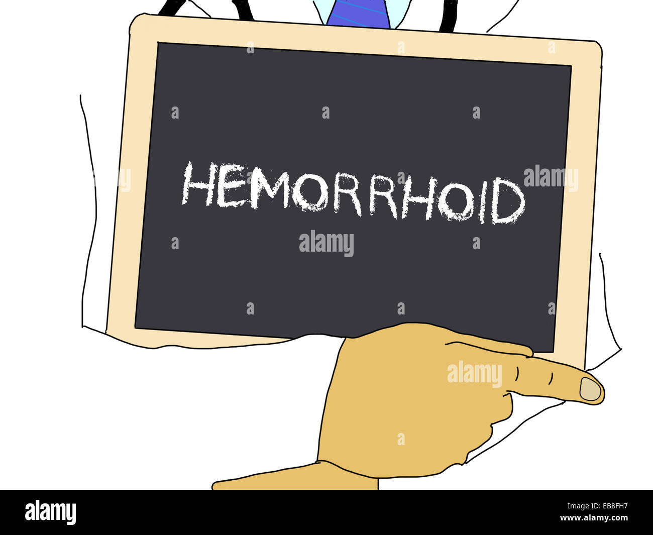 Illustration: Doctor shows information: hemorrhoid Stock Photo - Alamy