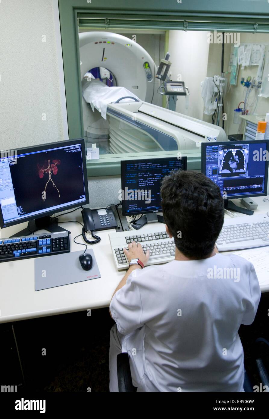 Shoulder ct scan hi-res stock photography and images - Alamy